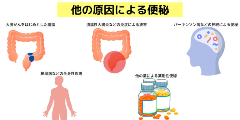 つらい便秘症状を治すには？便秘の原因や解消法について解説 ひまわり医院（内科・皮膚科）